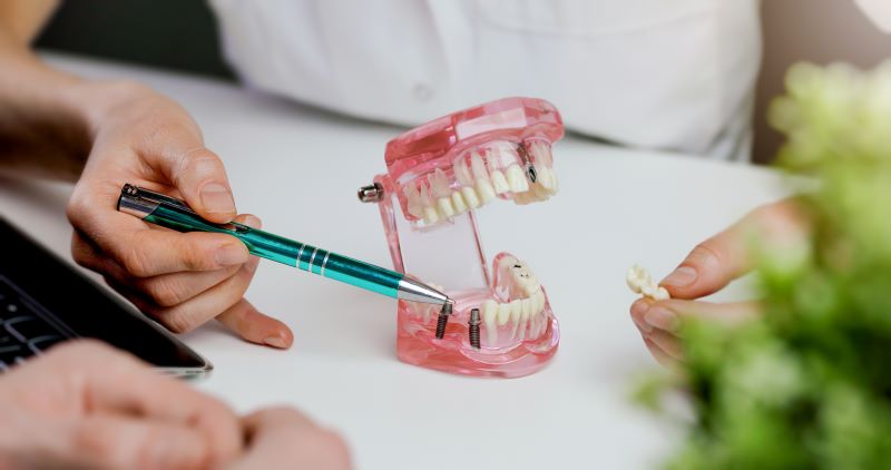 Removing a Failed Dental Implant: What to Expect